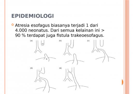 Esophageal Atresia - Atresia Esofagus - Kelainan Pada Esofagus