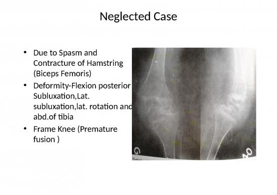 Physiotherapy Ppt 78179 | Tuberculosis Of Knee